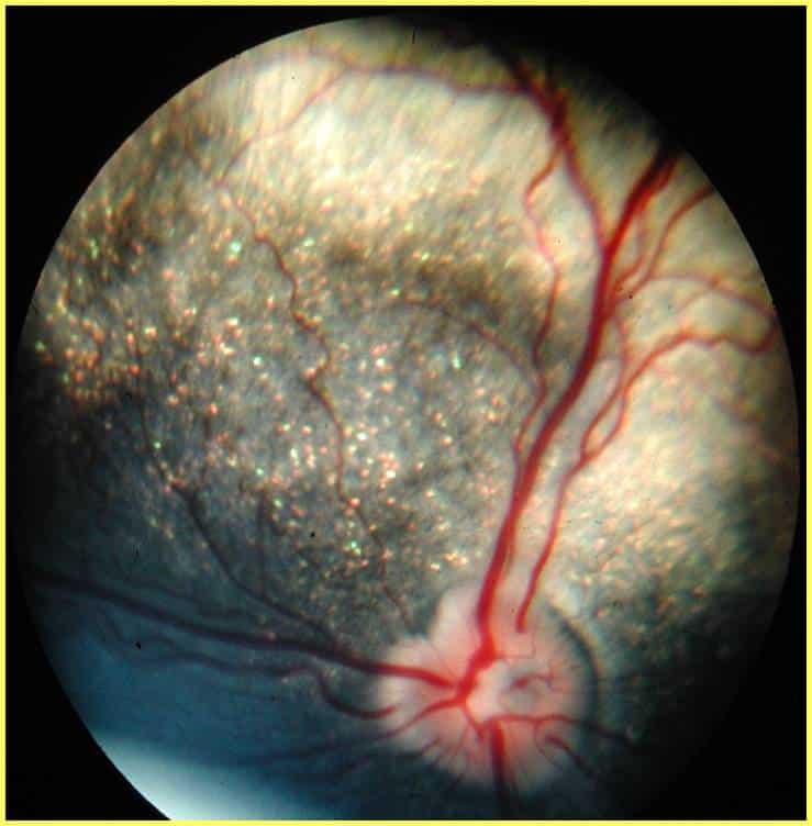 Practical Ophthalmoscopy Course Q1 CPD Solutions Course Information
