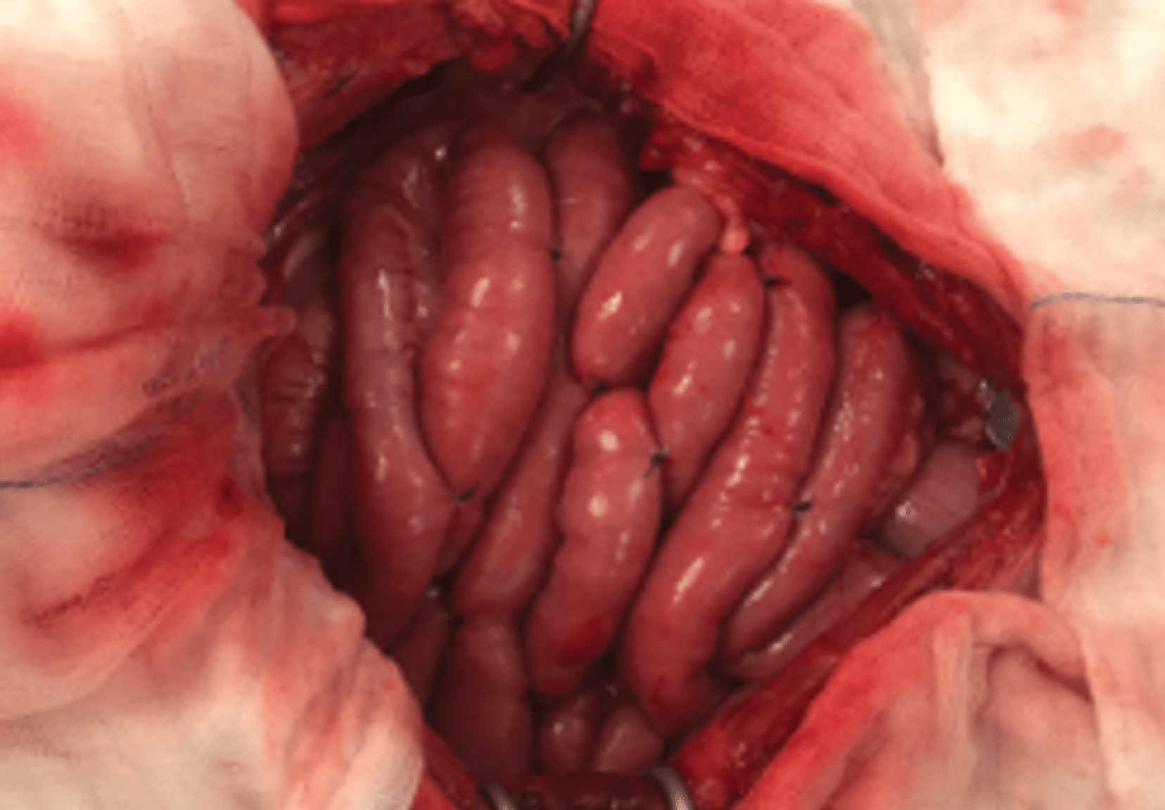 7 Secrets of Successful Soft Tissue Surgery -1 CPD Solutions Course ...