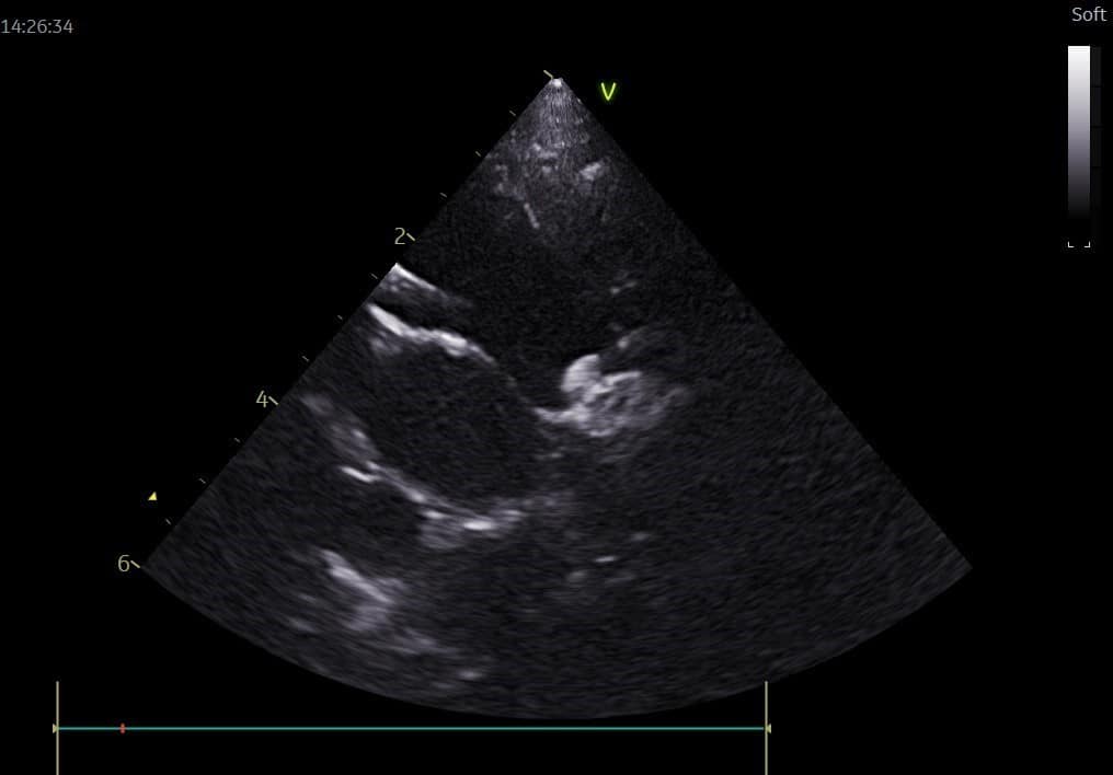 Practical Cardiac Ultrasound Scanning Day Q1 CPD Solutions Course ...